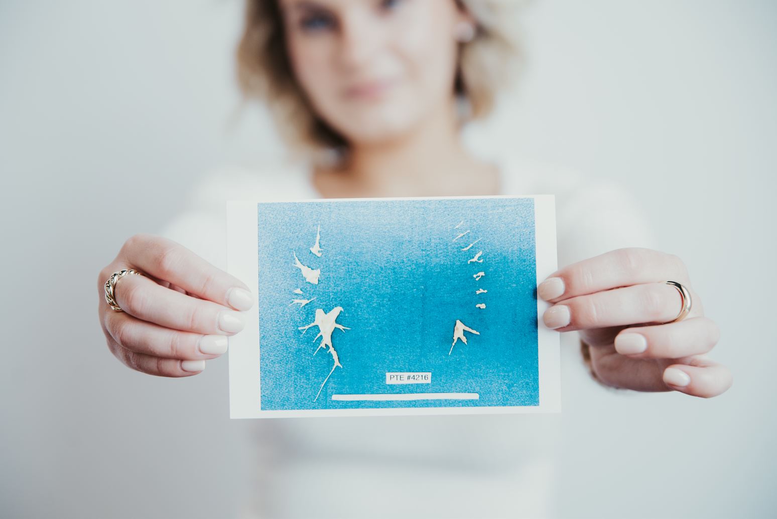 Alyson's Blood Clot Story - Alex Rowan Foundation